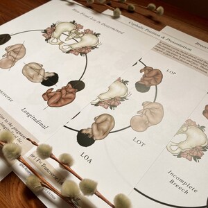 Fetal Position 3 Pack INSTANT DOWNLOAD Professional Handouts Pregnancy ...