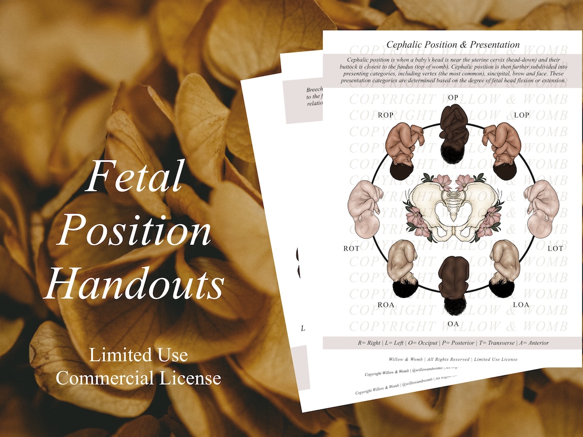 Fetal Position 3 Pack INSTANT DOWNLOAD Professional Handouts - Etsy