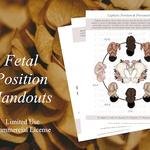 Fetal Position 3 Pack INSTANT DOWNLOAD Professional Handouts - Etsy