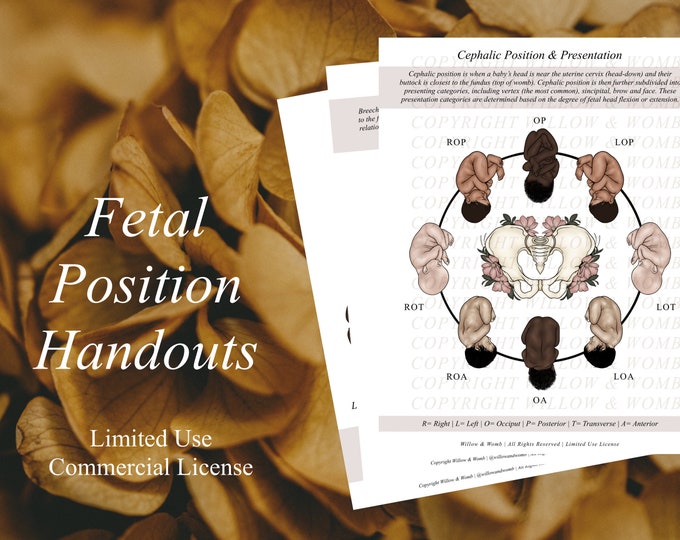 Fetal Position 3 Pack INSTANT DOWNLOAD Professional Handouts Pregnancy ...