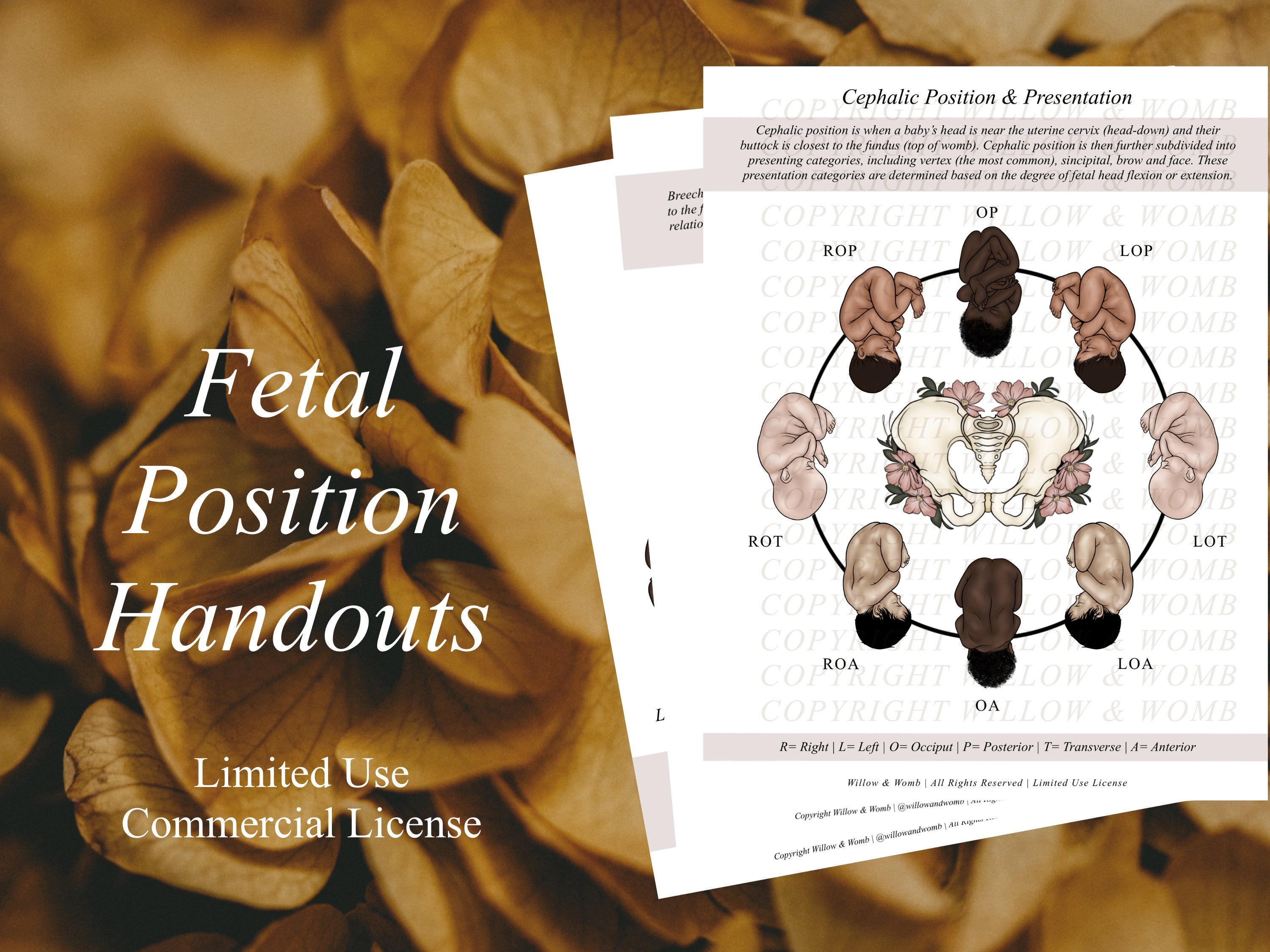Vertex Position Fetal Position In