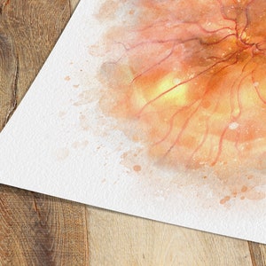 Eye Doctor Gift Retinal Detachment Watercolor-style Painting Retina Art ...