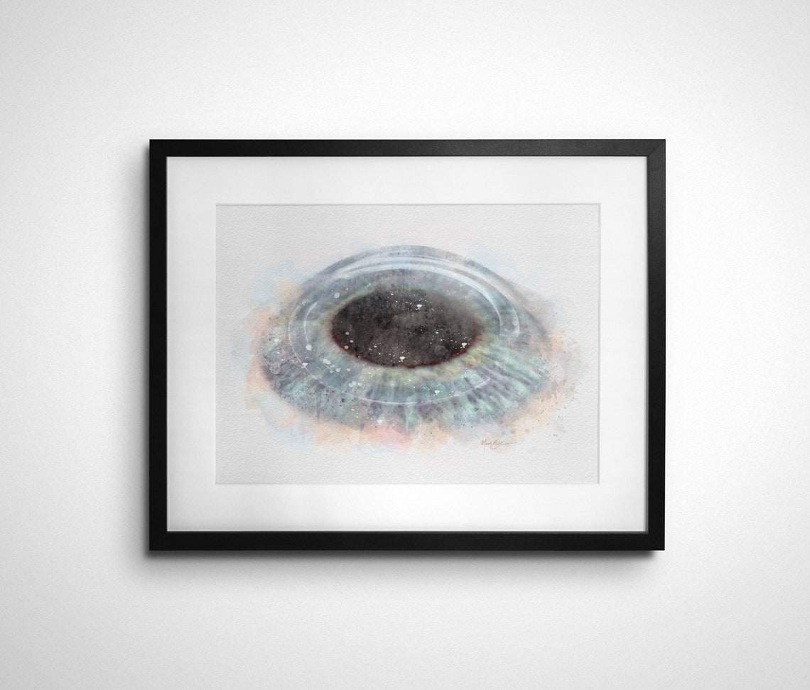 Cornea Doctor Gift Eye Art Print Intacs Corneal Inserts - Etsy