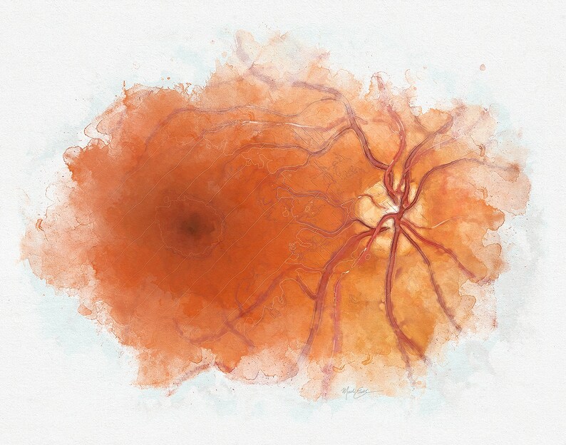 Retina Anatomy Art Print Mixed Media Style Ophthalmologist | Etsy