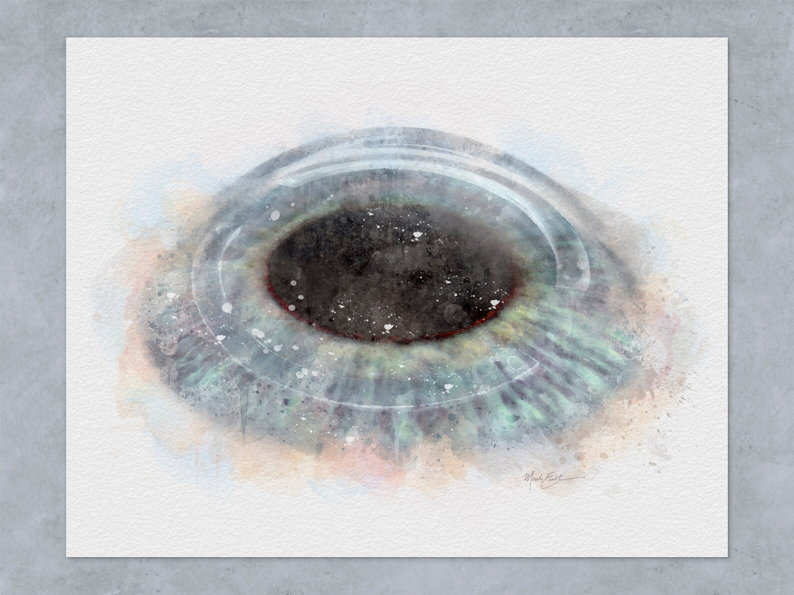 Cornea Doctor Gift Eye Art Print Intacs Corneal Inserts - Etsy
