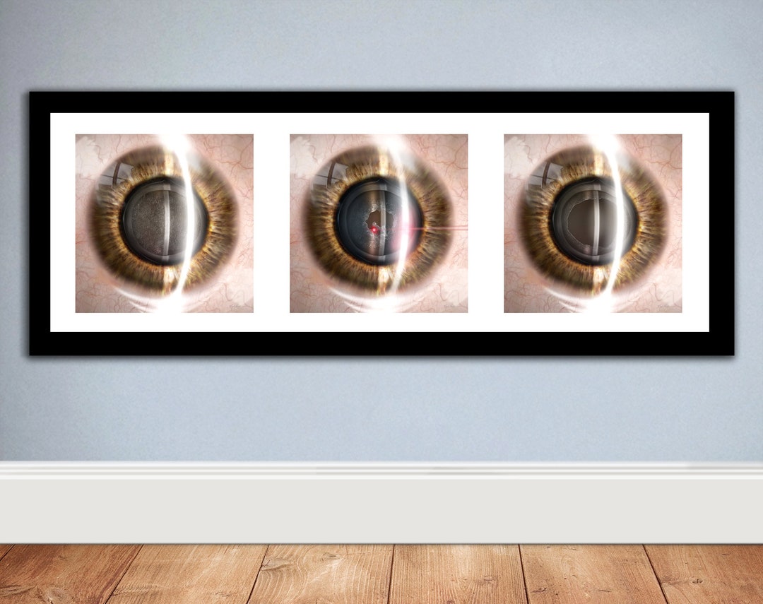 Eye Doctor Wall Art, YAG Laser Capsulotomy Illustrations Print Eye ...