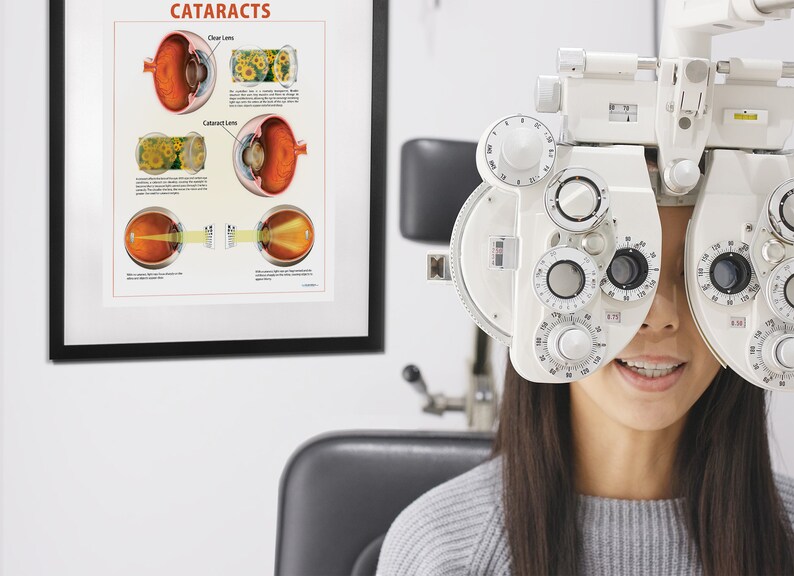 Cataract Poster DIGITAL DOWNLOAD. Eye Doctor Exam Room Instant ...
