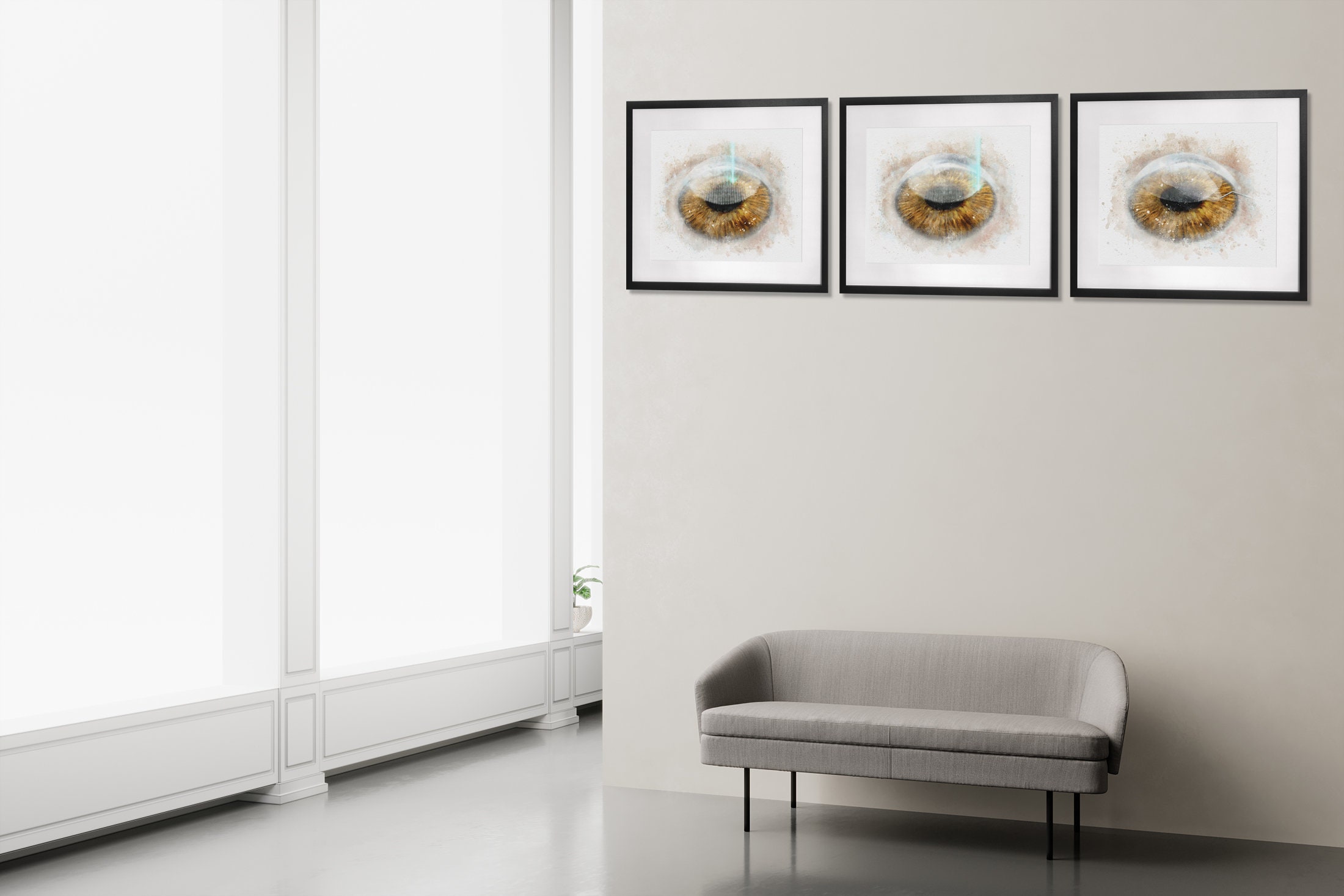 SMILE Laser Eye Surgery Art Print Collection 25% off These 3 - Etsy