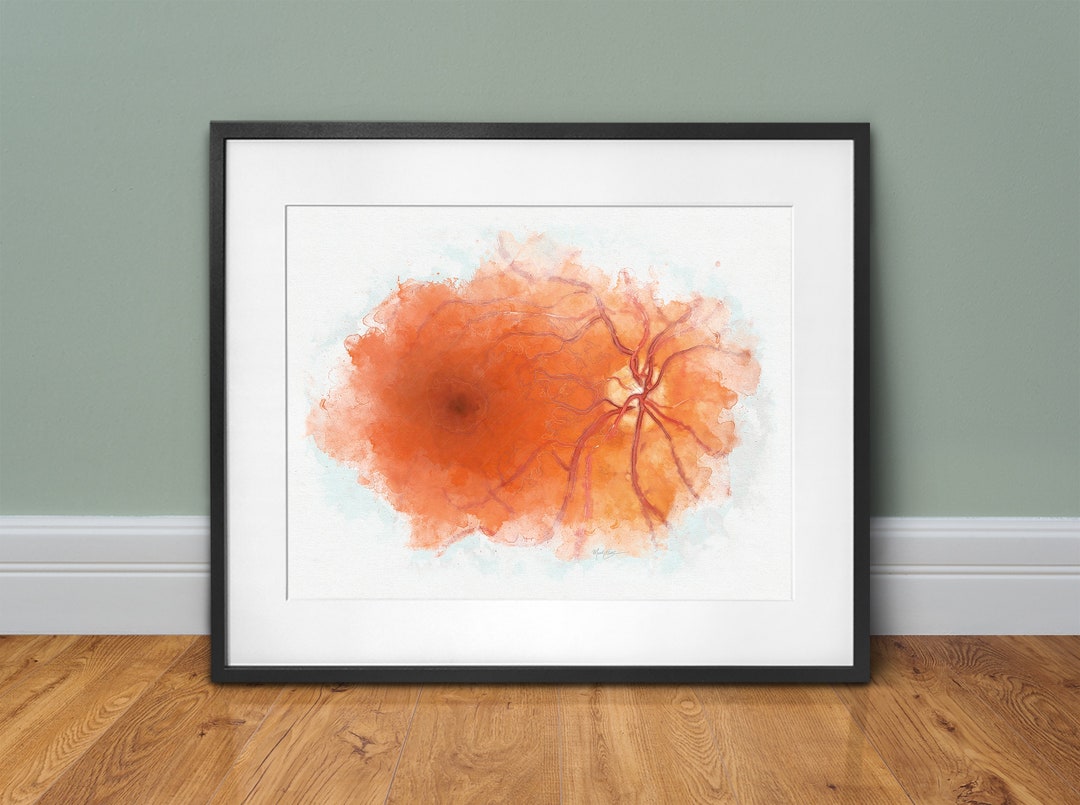 Retina Anatomy Art Print, Mixed Media Style Ophthalmologist and ...