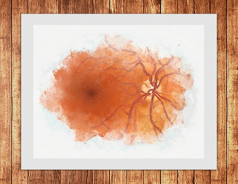 Retina Anatomy Art Print, Mixed Media Style Ophthalmologist and ...