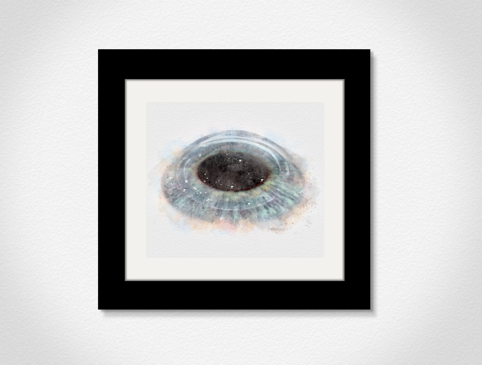 Cornea Doctor Gift Eye Art Print Intacs Corneal Inserts - Etsy