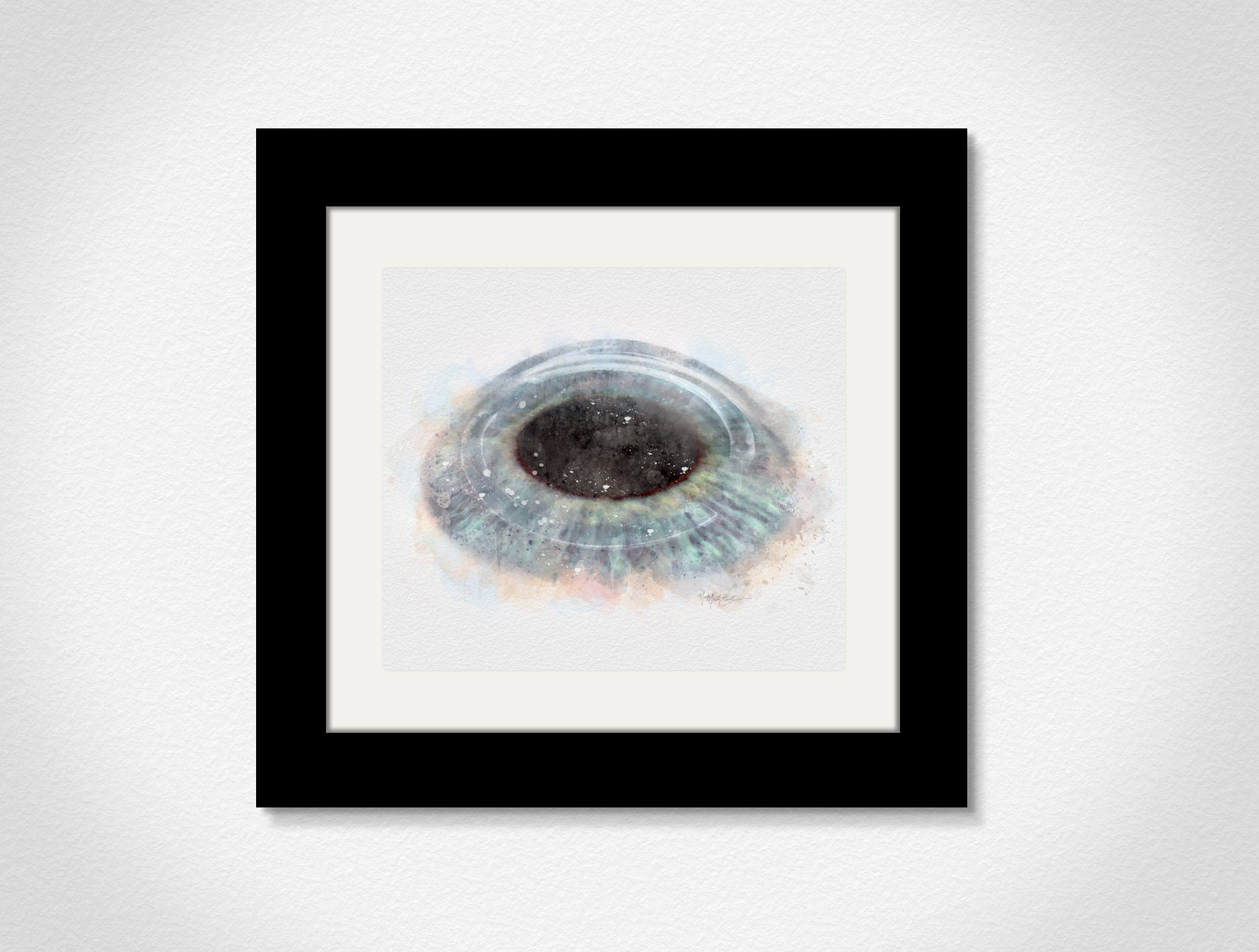 Cornea Doctor Gift Eye Art Print Intacs Corneal Inserts - Etsy