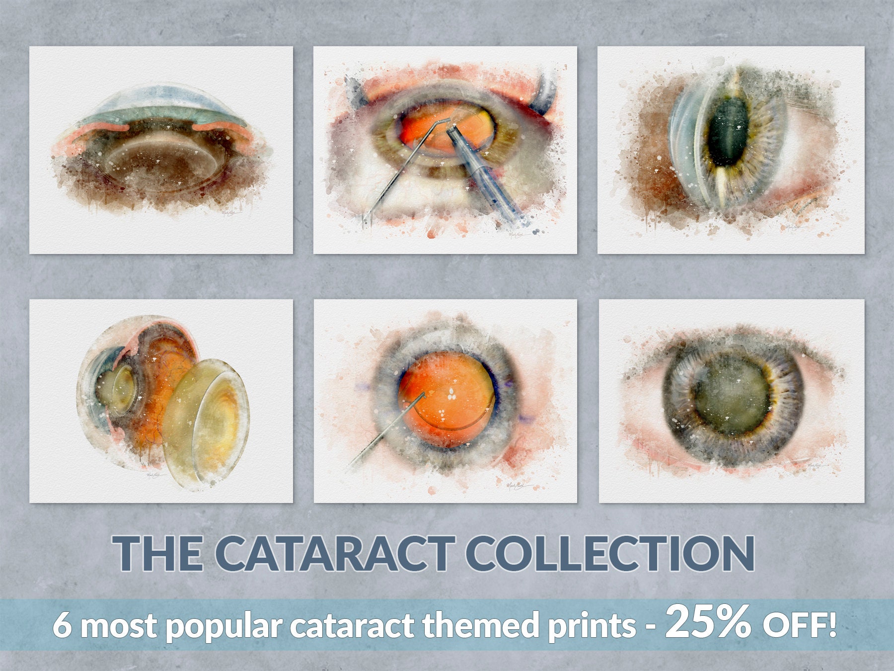 The Cataract Collection These 6 Cataract Themed Art Prints | Etsy