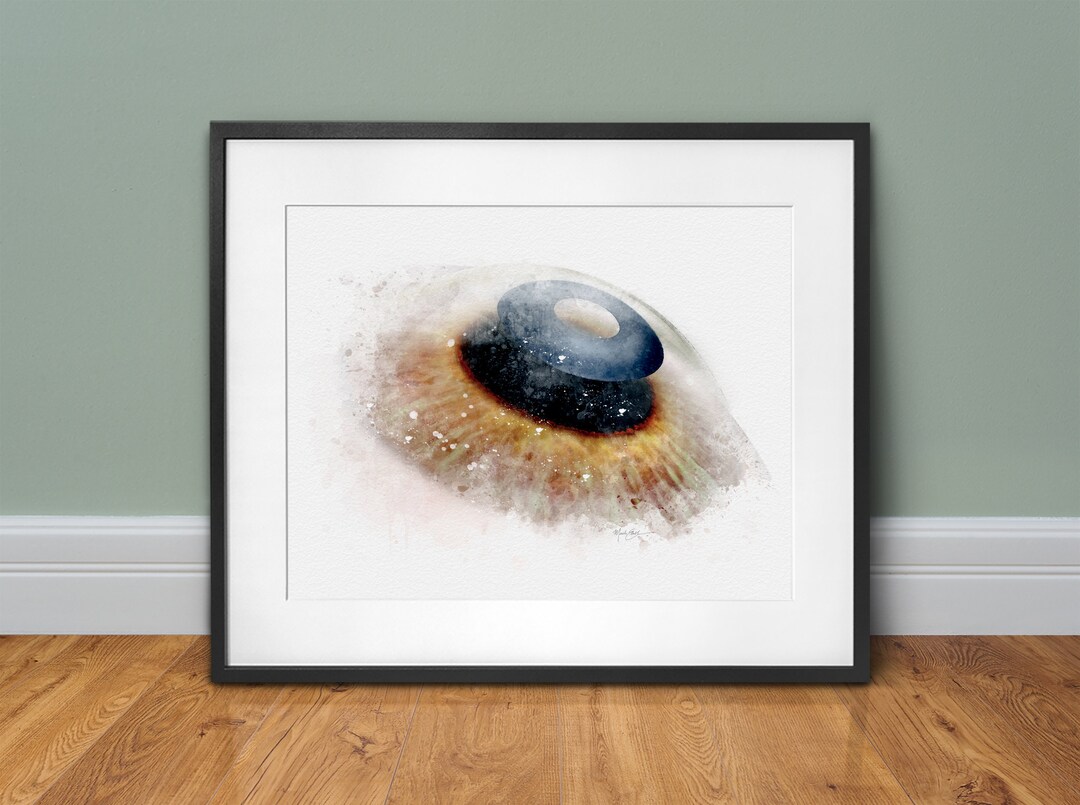 Cornea Doctor Gift KAMRA Inlay Corneal Implant Watercolor Style Art ...