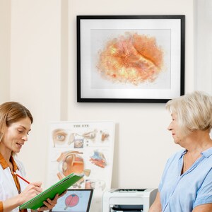 Eye Doctor Gift Retinal Detachment Watercolor-style Painting Retina Art ...