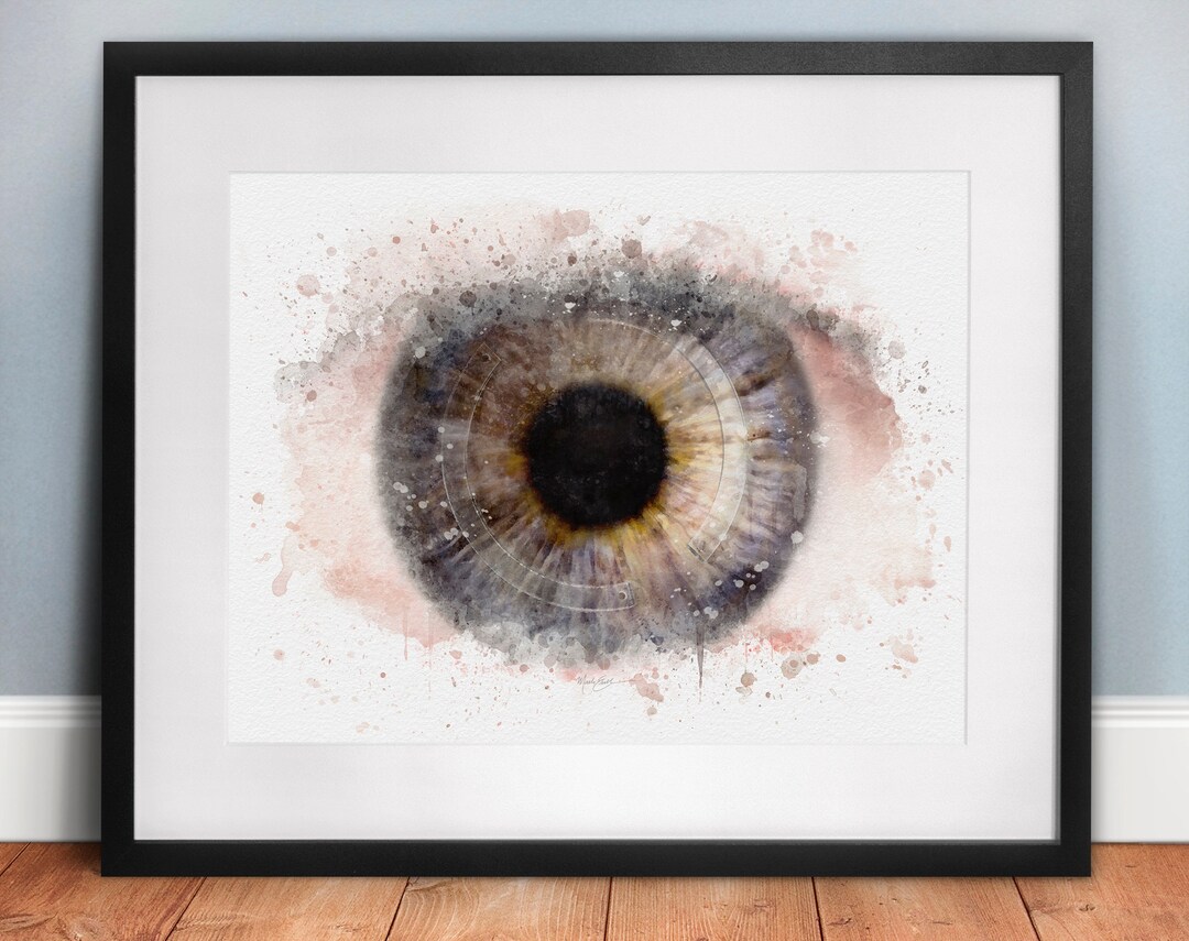 Cornea Specialist Gift Eye Art Print Intacs Corneal Inserts - Etsy