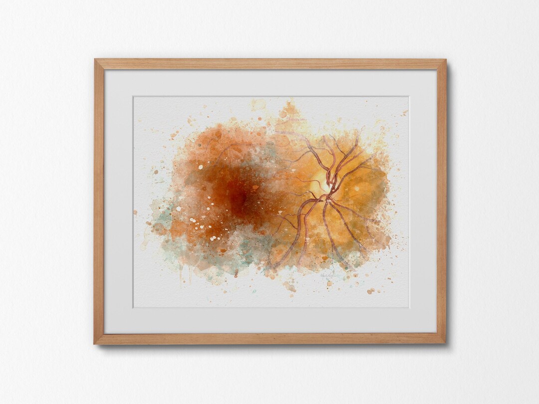 Retina Art Print – Wall Art for Eye Doctors, Retina Specialists ...