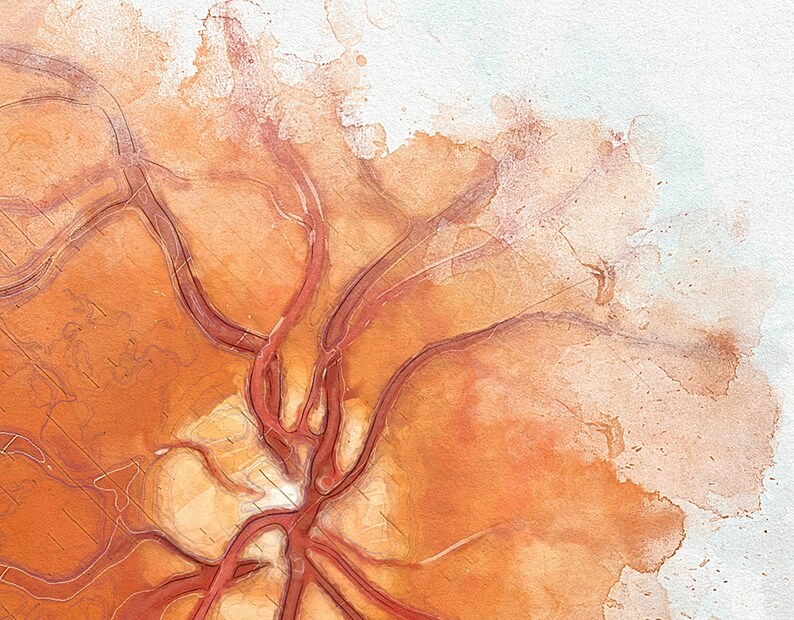Retina Anatomy Art Print Mixed Media Style Ophthalmologist | Etsy