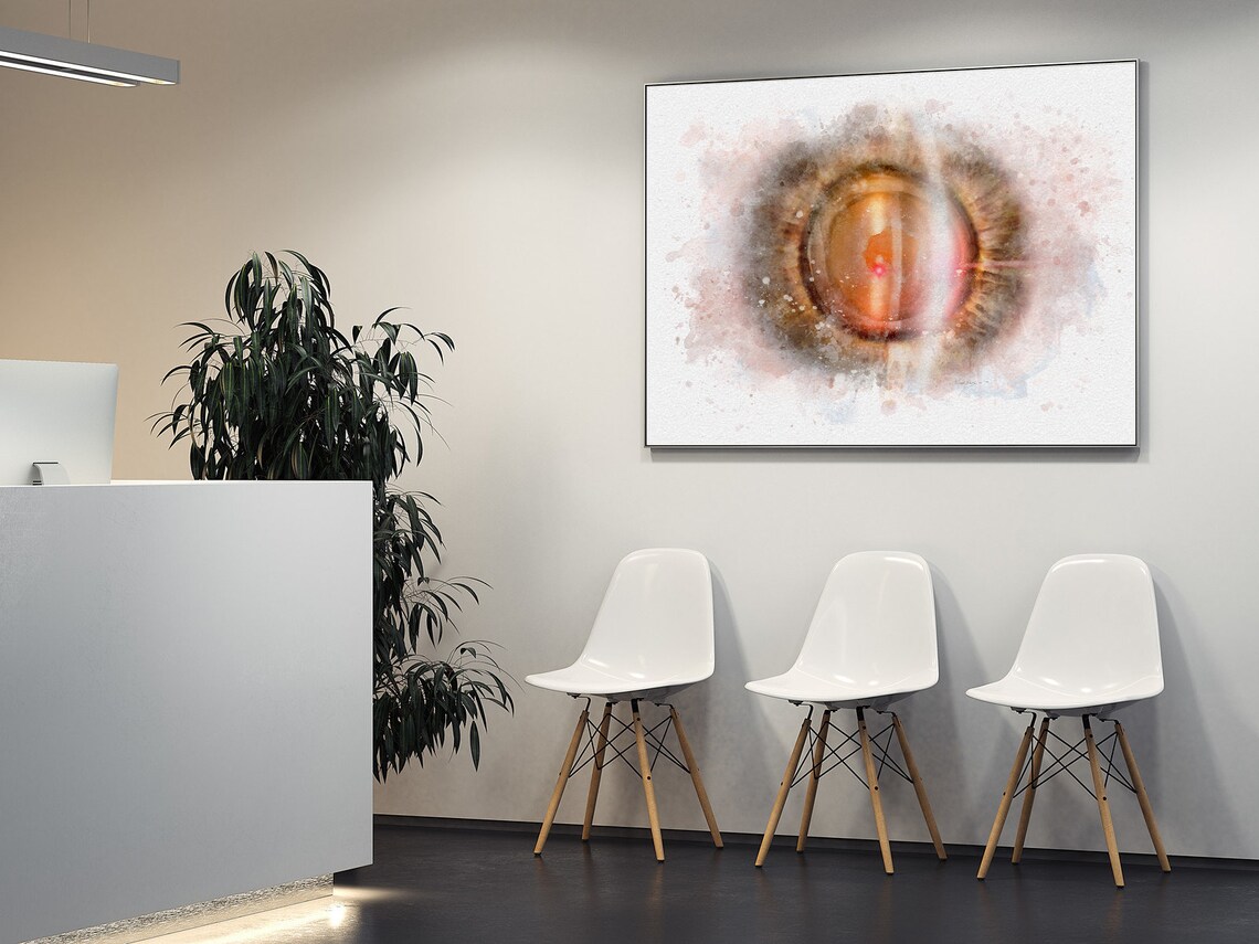 YAG Laser Ophthalmology Art Print Eye Doctor Gift Eye Surgery | Etsy