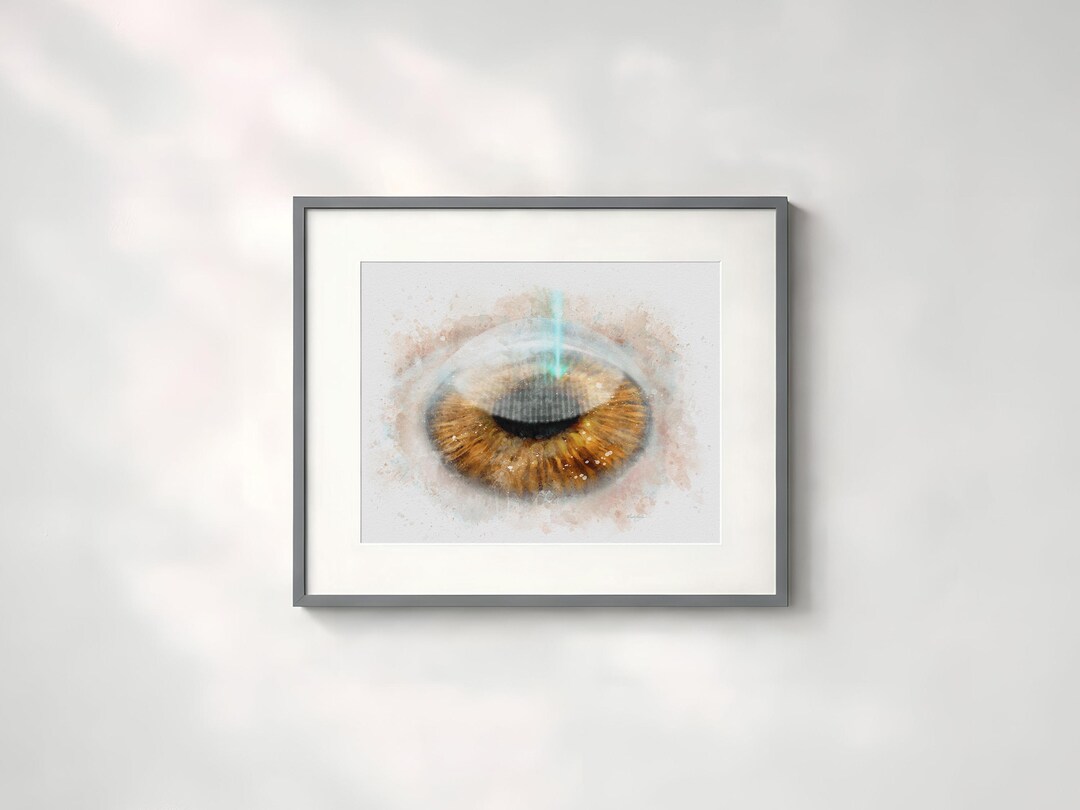 Corneal Surgeon Gift Eye Art Print SMILE Refractive Eye Surgery ...
