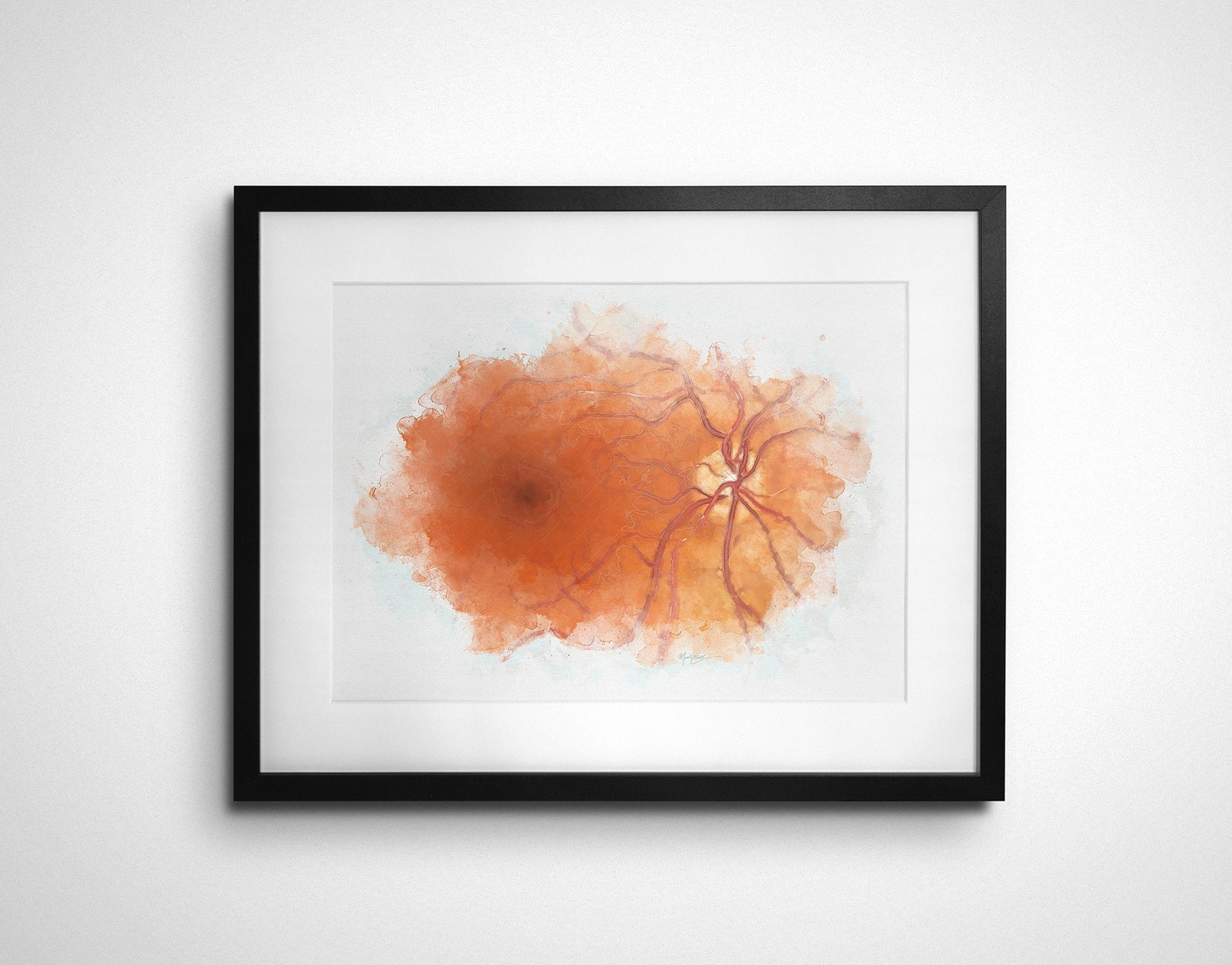 Retina Anatomy Art Print, Mixed Media Style Ophthalmologist and ...