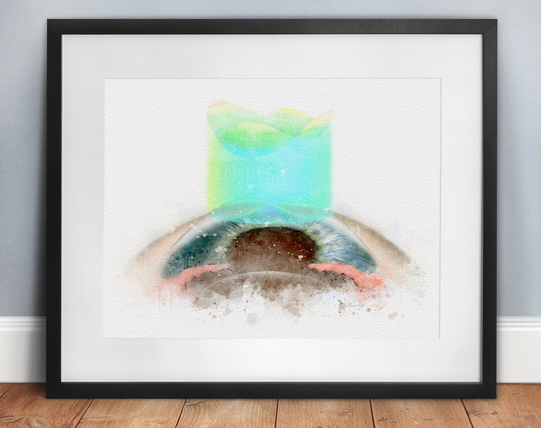 Lasik Doctor Gift Lasik Art Wavefront PRK Laser Eye Surgery - Etsy