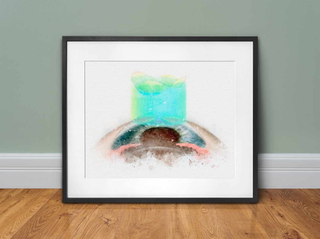 Lasik Doctor Gift, Lasik Art, Wavefront PRK Laser Eye Surgery ...