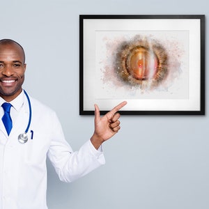 YAG Laser Ophthalmology Art Print Eye Doctor Gift, Eye Surgery Art ...