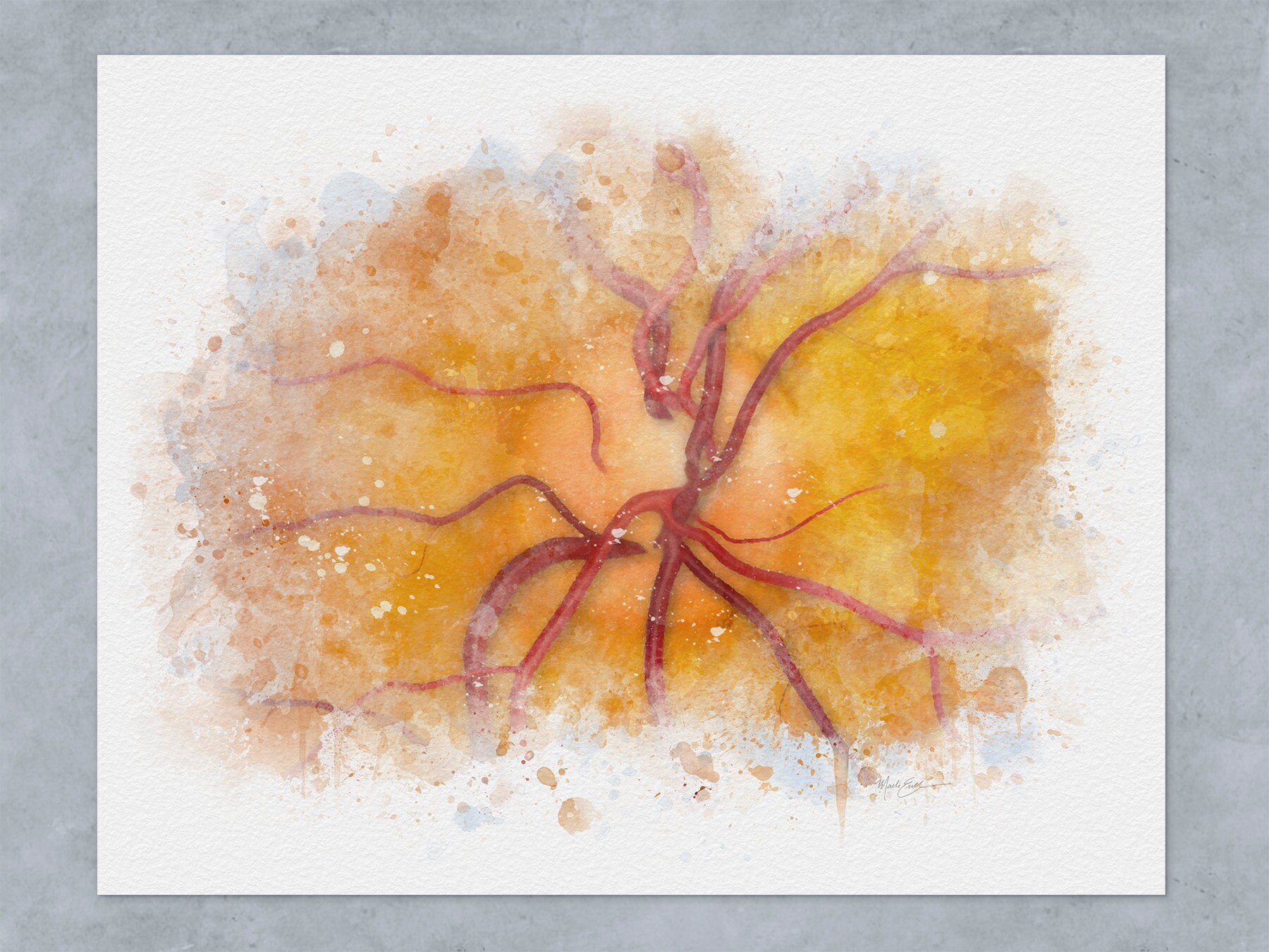 Optic Nerve Art Print in Watercolor Style Glaucoma Doctor | Etsy