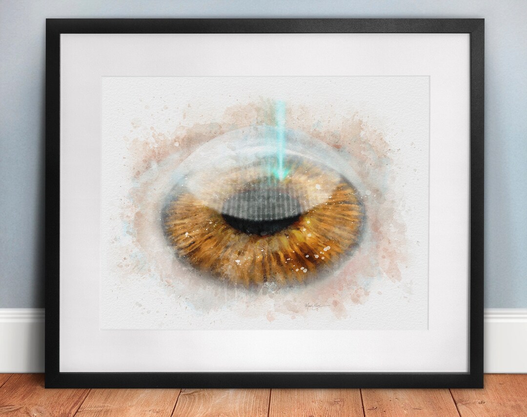 Corneal Surgeon Gift Eye Art Print SMILE Refractive Eye - Etsy