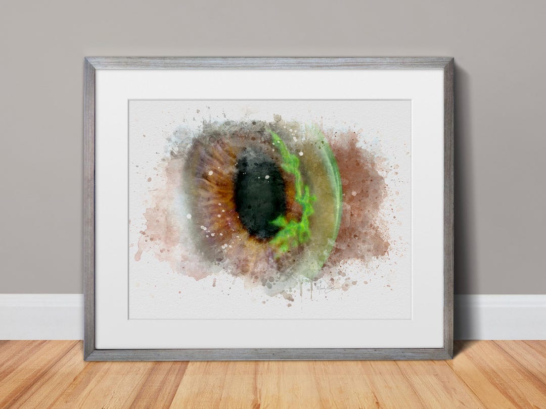 Ophthalmology Art Gift, HSK Keratitis Art Print, Optometrist Gift, Eye ...