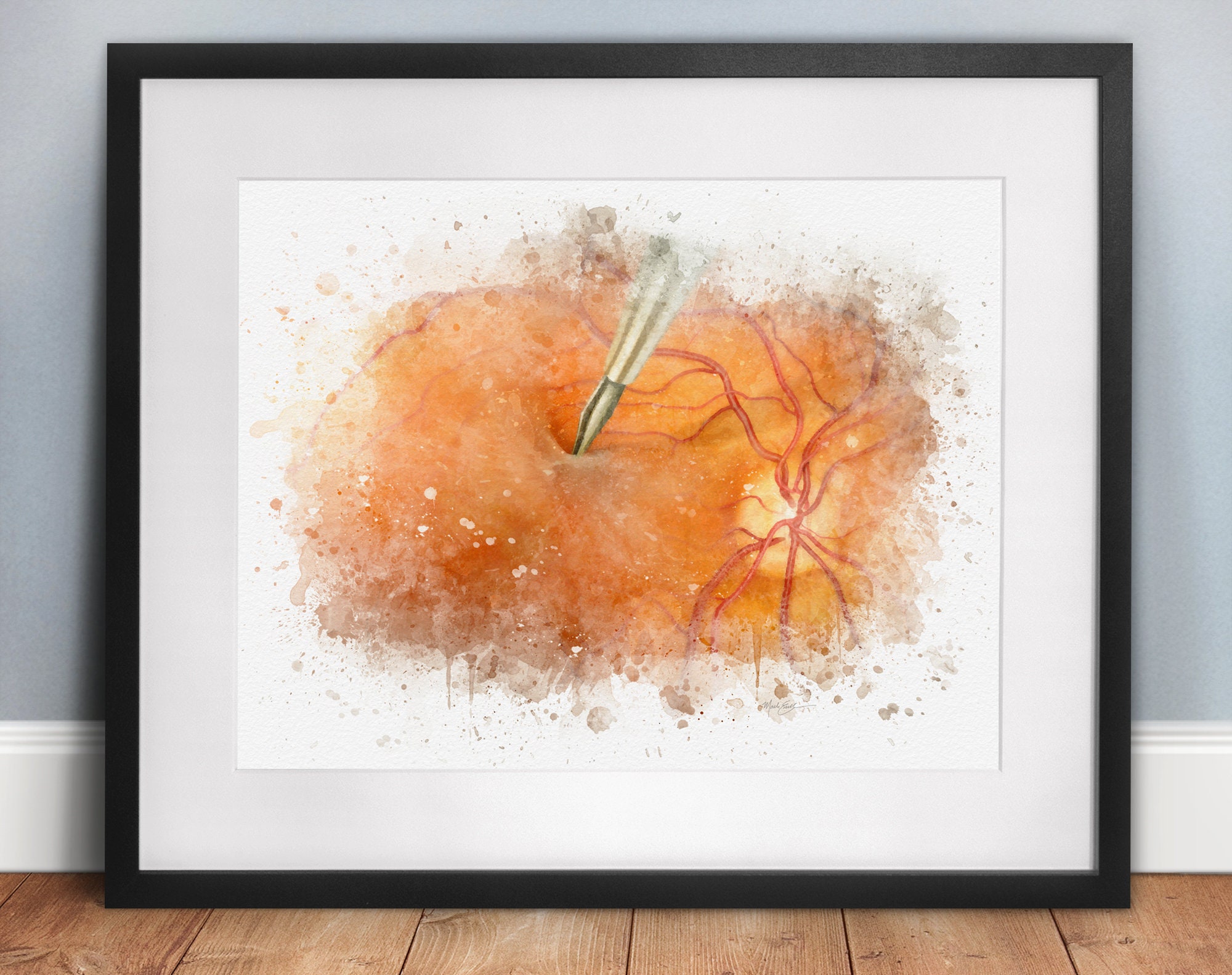 Retina Doctor Gift Retina Art Print Retina Surgery Wall | Etsy