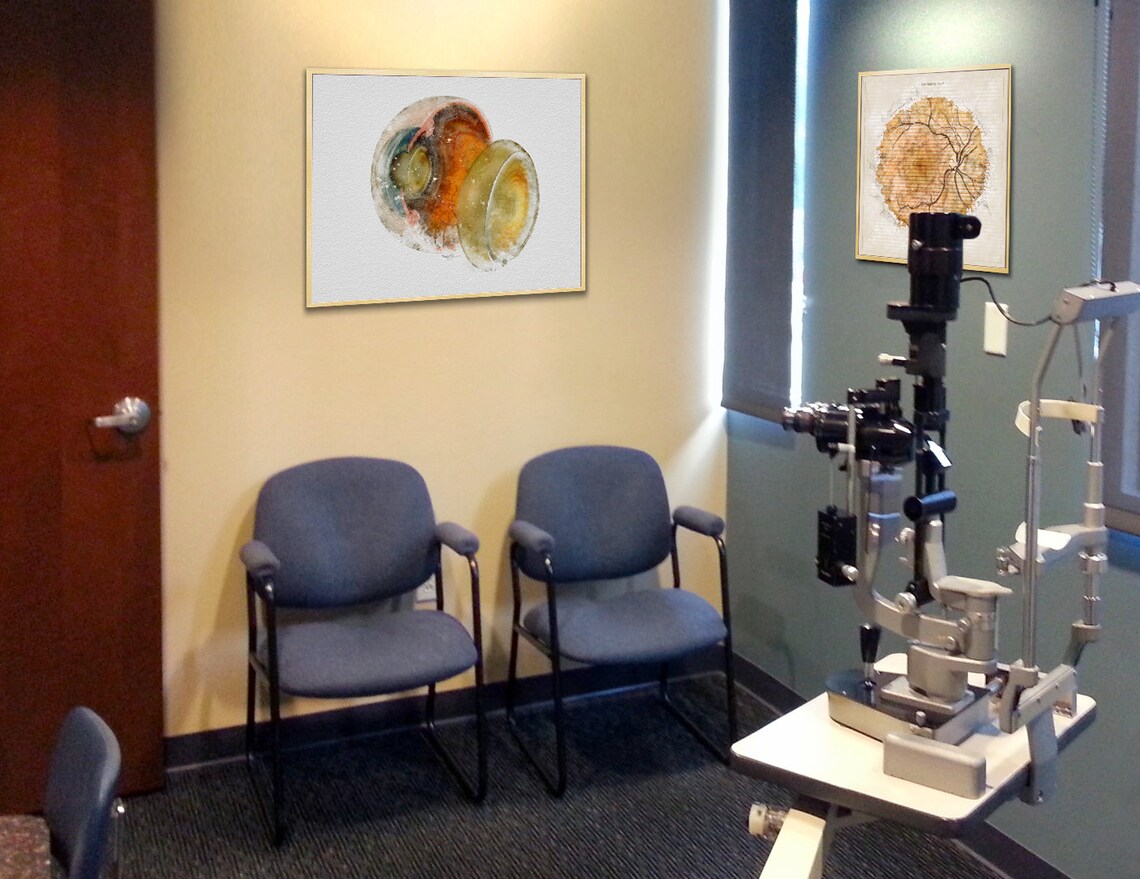 Cataract Surgery Art Prints Collection – Watercolor Style Art Prints ...