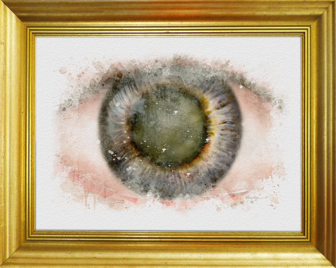 Eye Doctor Decor Optometrist Office Wall Art Cataract Art - Etsy