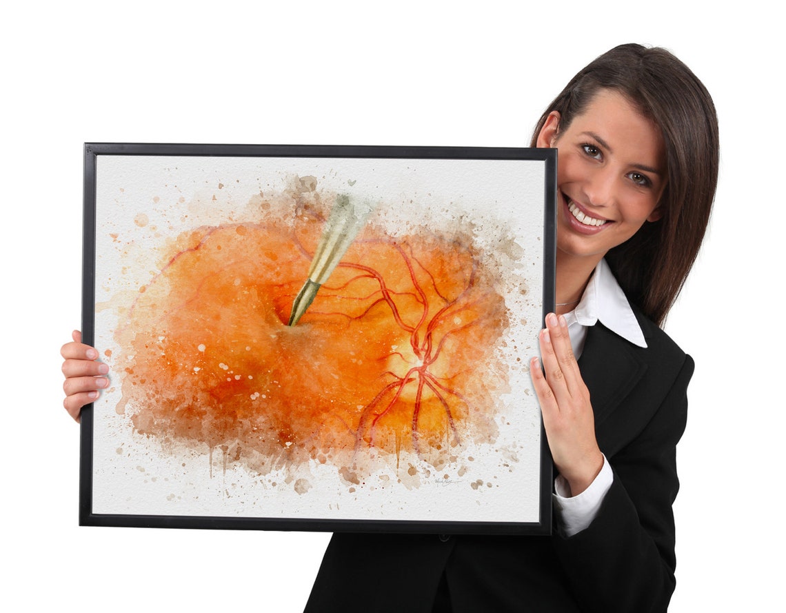 Retina Doctor Gift Retina Art Print Retina Surgery Wall | Etsy