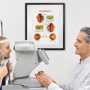 Cataract Poster DIGITAL DOWNLOAD. Eye Doctor Exam Room Instant ...