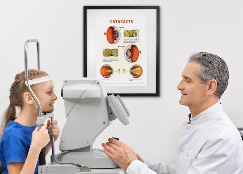 Cataract Poster DIGITAL DOWNLOAD. Eye Doctor Exam Room Instant ...