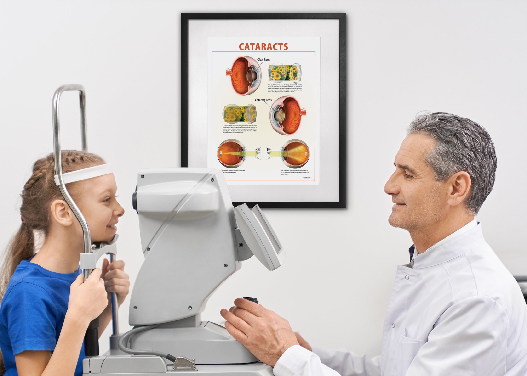 Cataract Poster DIGITAL DOWNLOAD. Eye Doctor Exam Room Instant ...