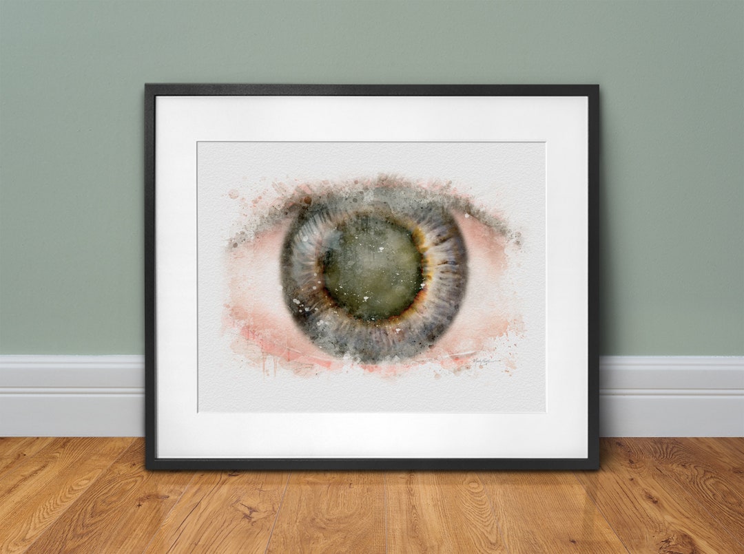 Eye Doctor Décor, Optometrist Office Wall Art, Cataract Art Print ...