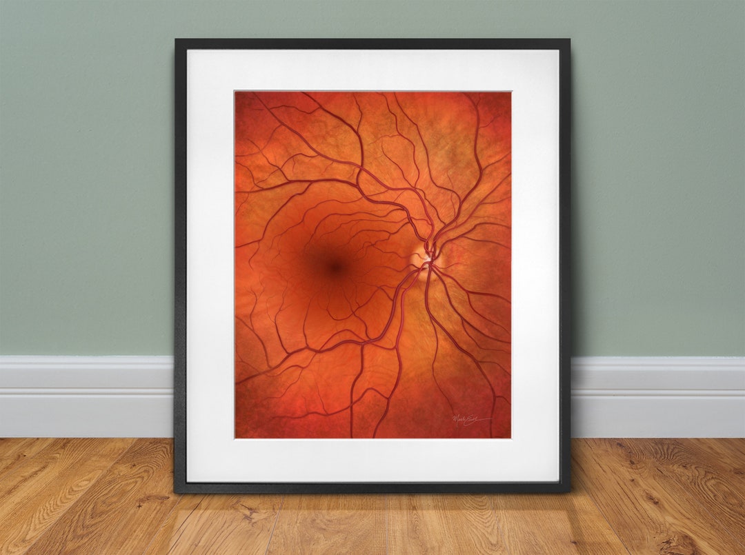 Eye Doctor Gift Retina Anatomy Art Print, Retina and Macula Art Eye ...