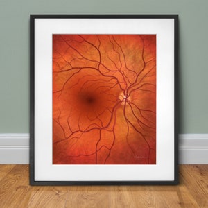 Eye Doctor Gift Retina Anatomy Art Print, Retina and Macula Art Eye ...