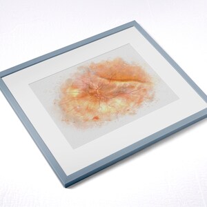 Eye Doctor Gift Retinal Detachment Watercolor-style Painting Retina Art ...