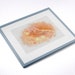 Eye Doctor Gift Retinal Detachment Watercolor-style Painting Retina Art ...