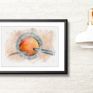 Cataract Surgeon Gift | Cataract Surgery Watercolor Style Eye Wall ...