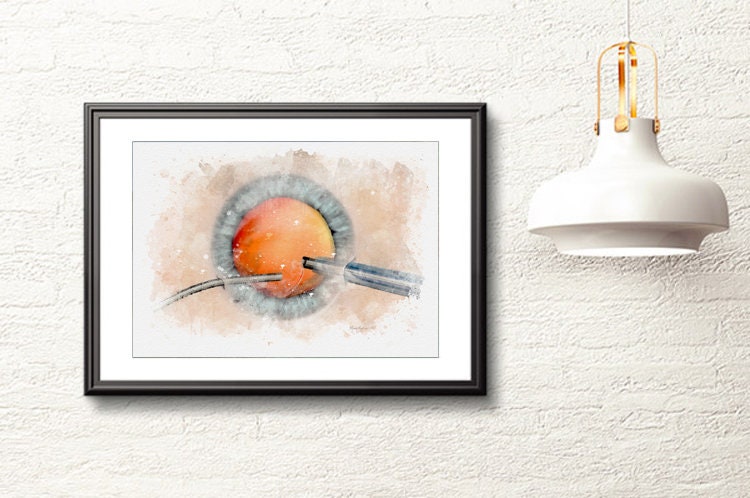 Cataract Surgeon Gift | Cataract Surgery Watercolor Style Eye Wall ...