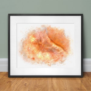 Eye Doctor Gift Retinal Detachment Watercolor-style Painting Retina Art ...