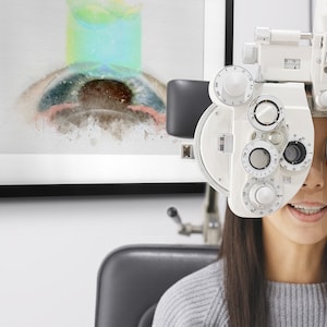 Lasik Doctor Gift, Lasik Art, Wavefront PRK Laser Eye Surgery ...