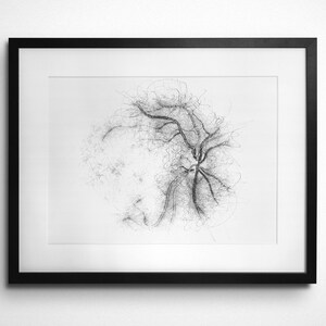 Retina Eye Anatomy Line Art Print Custom Eye Doctor Wall Art and ...