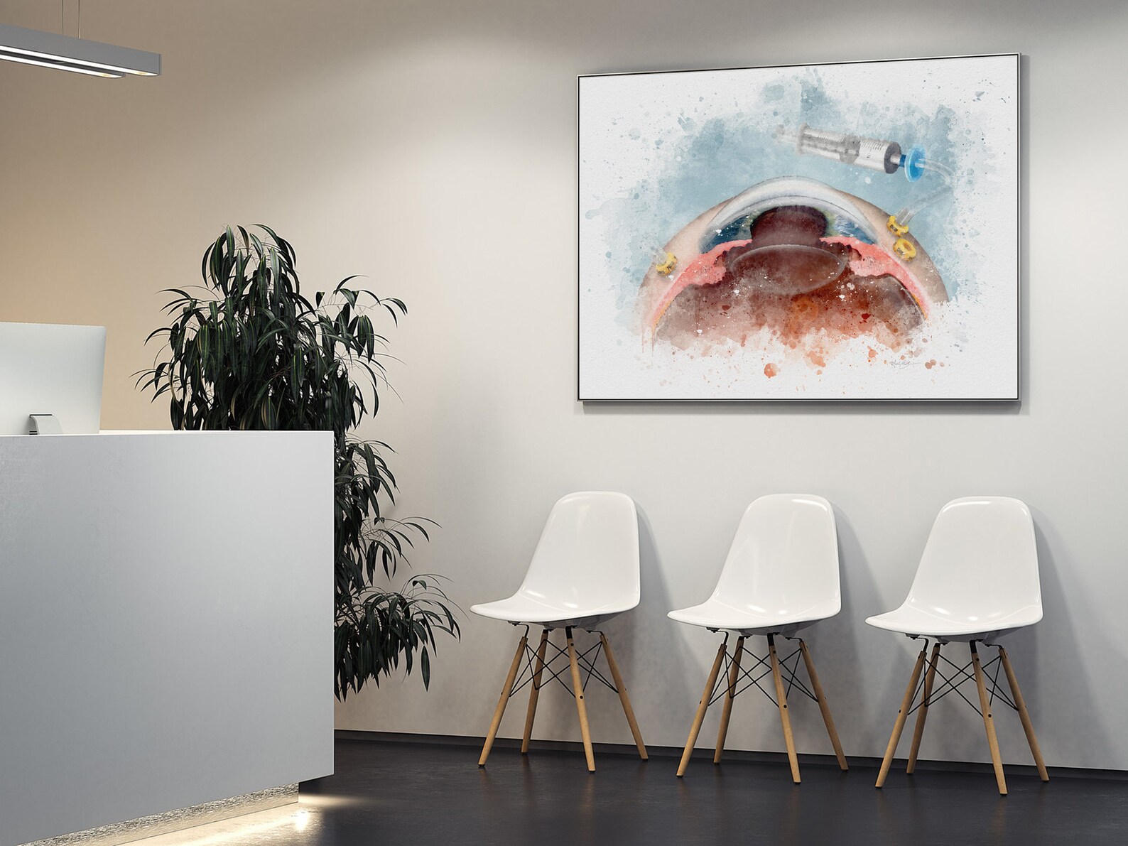 Retina Surgery Art Ophthalmologist Gift Retina Specialist - Etsy