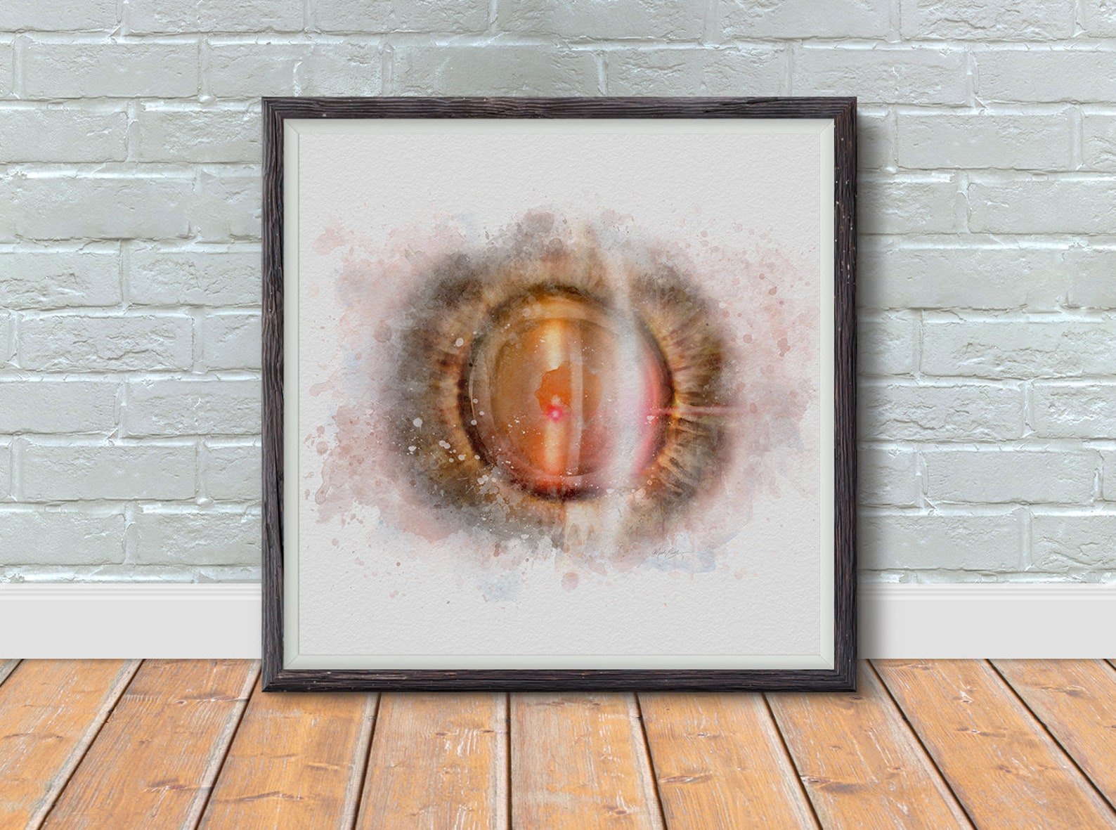 YAG Laser Ophthalmology Art Print Eye Doctor Gift Eye Surgery | Etsy